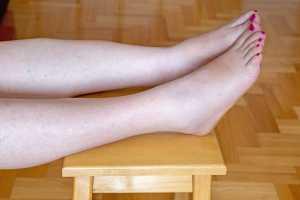 Swollen Feet After a C-Section - What You Need to Know!
